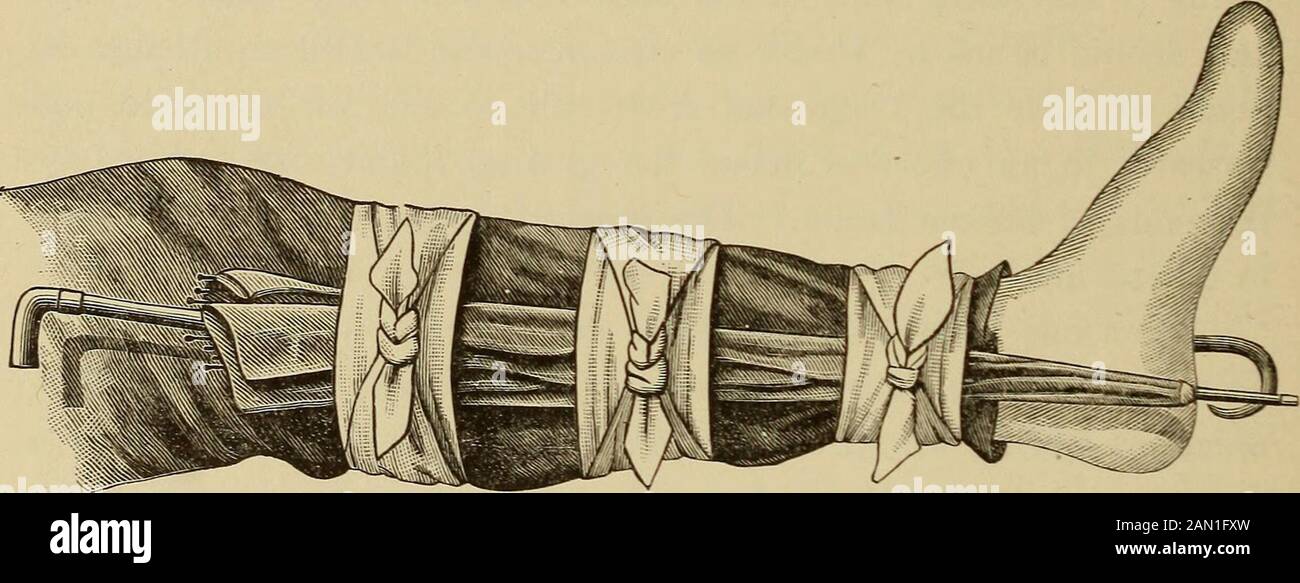 Temporary splint hi-res stock photography and images - Alamy