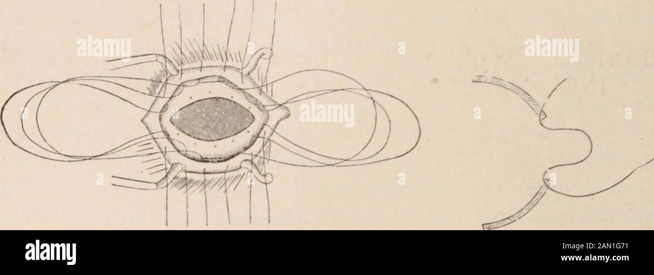 Nose sutures hi-res stock photography and images - Alamy