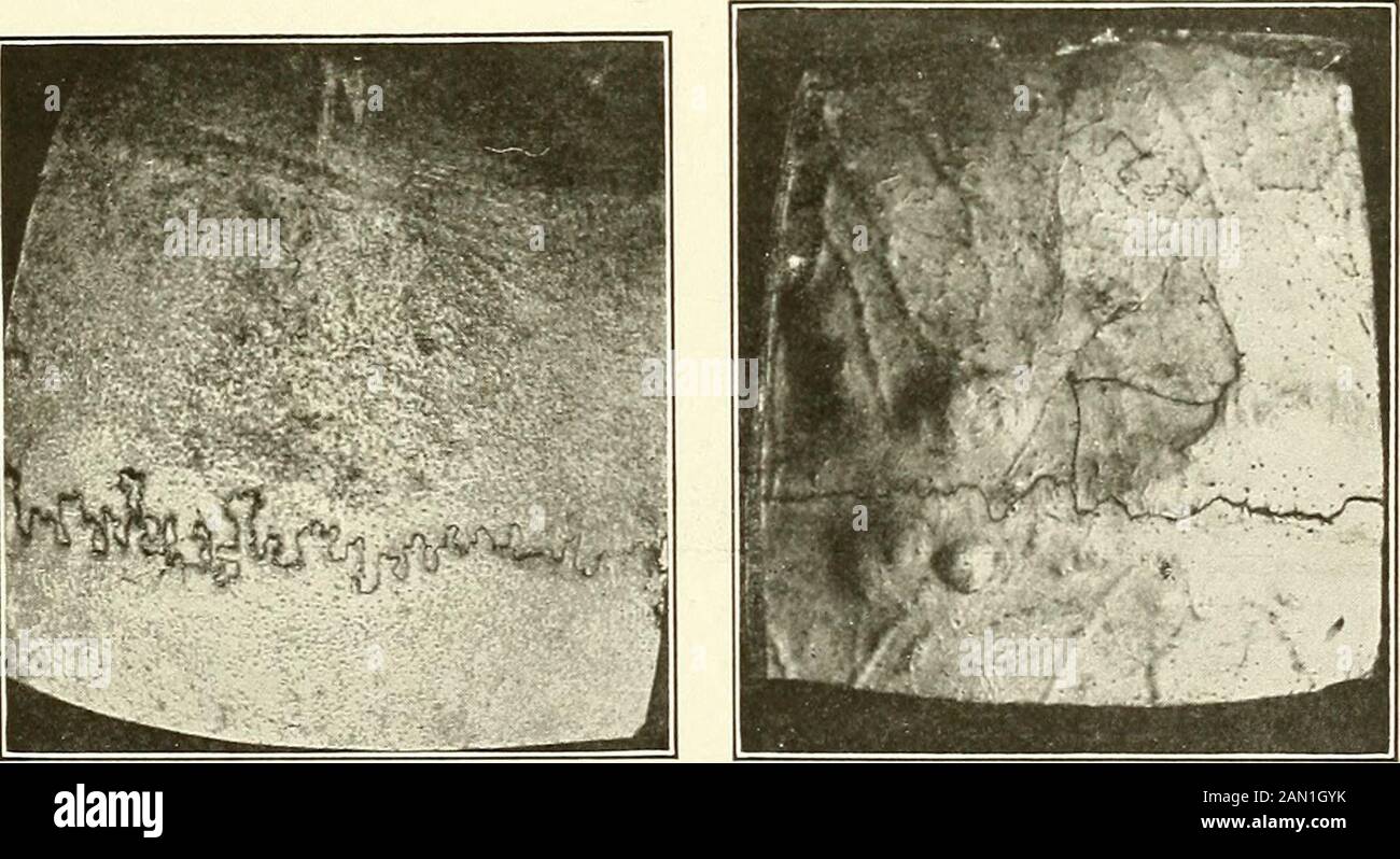 Gunshot injuries : how they are inflicted : their complications and ...