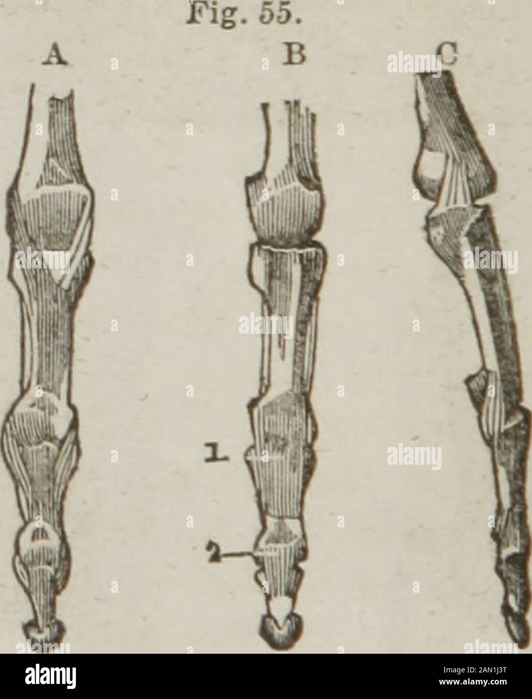 Carpal Bones Anterior View