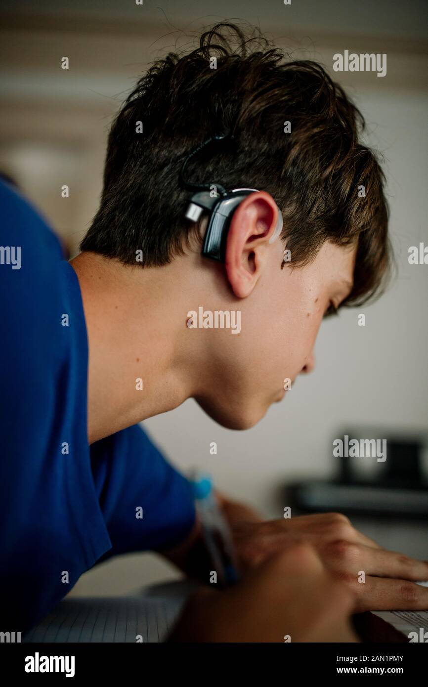 Cochlear Implant High Resolution Stock Photography and Images - Alamy