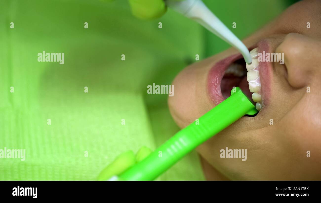Stomatologist washing patient teeth with irrigator after bleaching ...