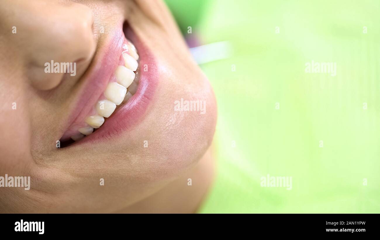 Snow-white teeth of satisfied dentistry customer, bleaching procedure ...