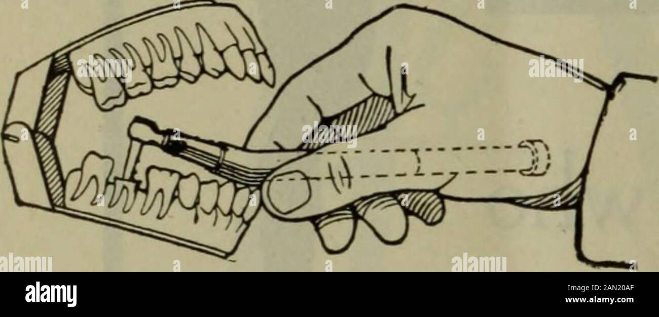 The Dental cosmos . ILLUSTRATED IN RIGHT AND WRONG SELF-CLEANSING A ...