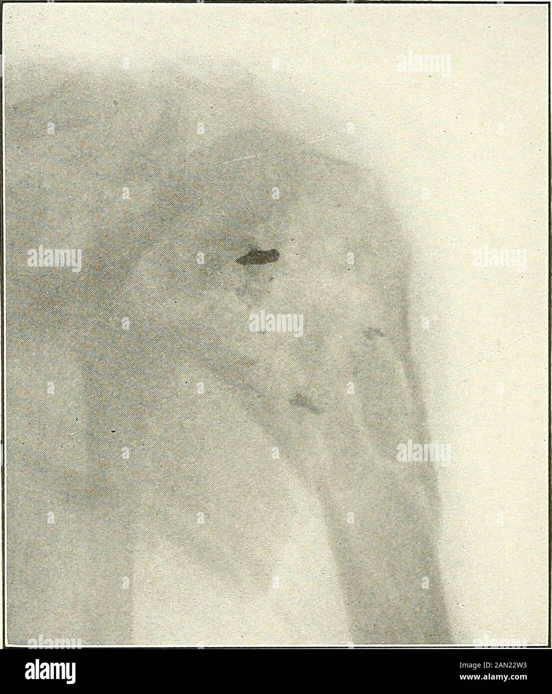 Gunshot injuries : how they are inflicted : their complications and ...