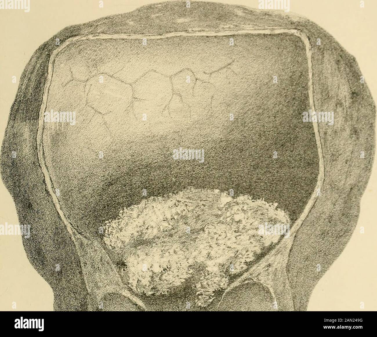 Clinical lectures on stricture of the urethra and other disorders of ...