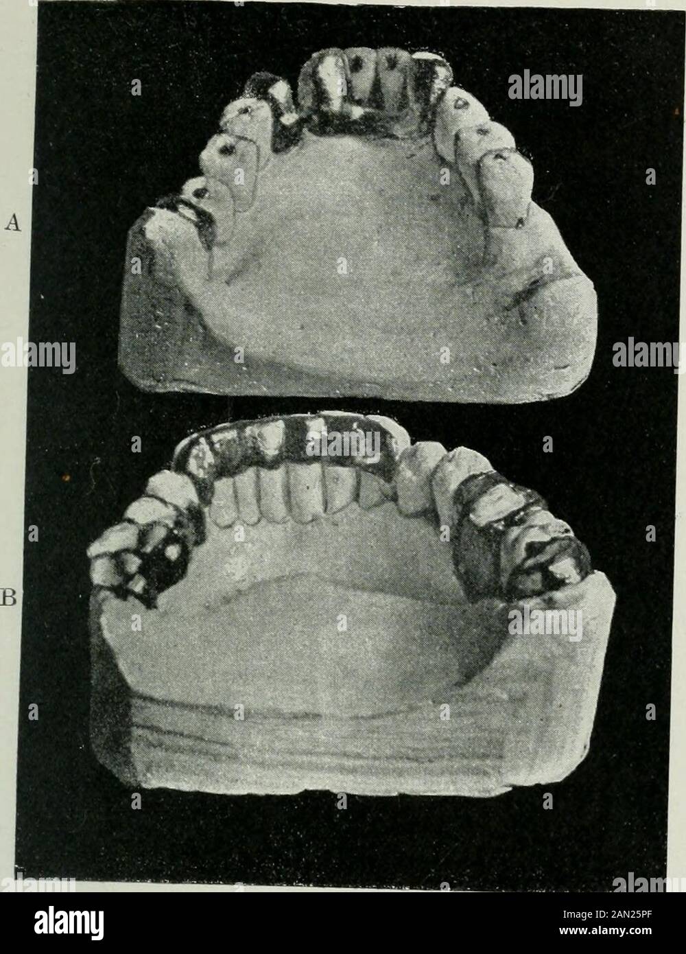 Spiders have teeth hi-res stock photography and images - Alamy