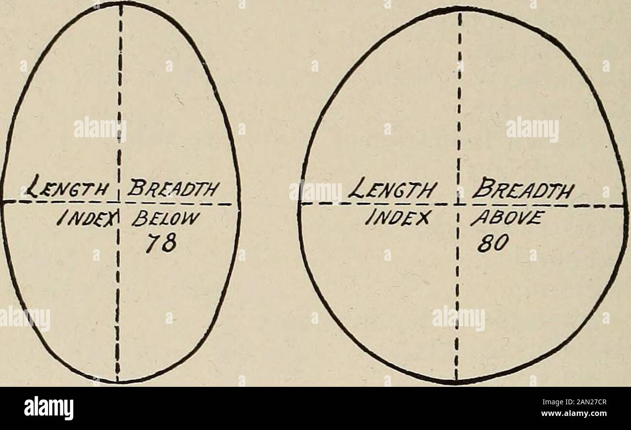 Dolichocephalic hi-res stock photography and images - Alamy