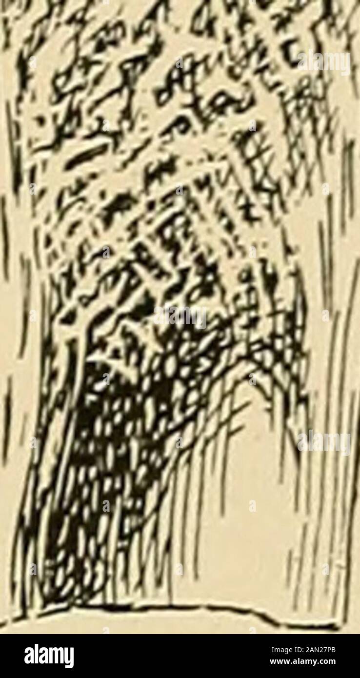 The treatment of fractures . Fig. 362.—Fracture of femoral neck ...