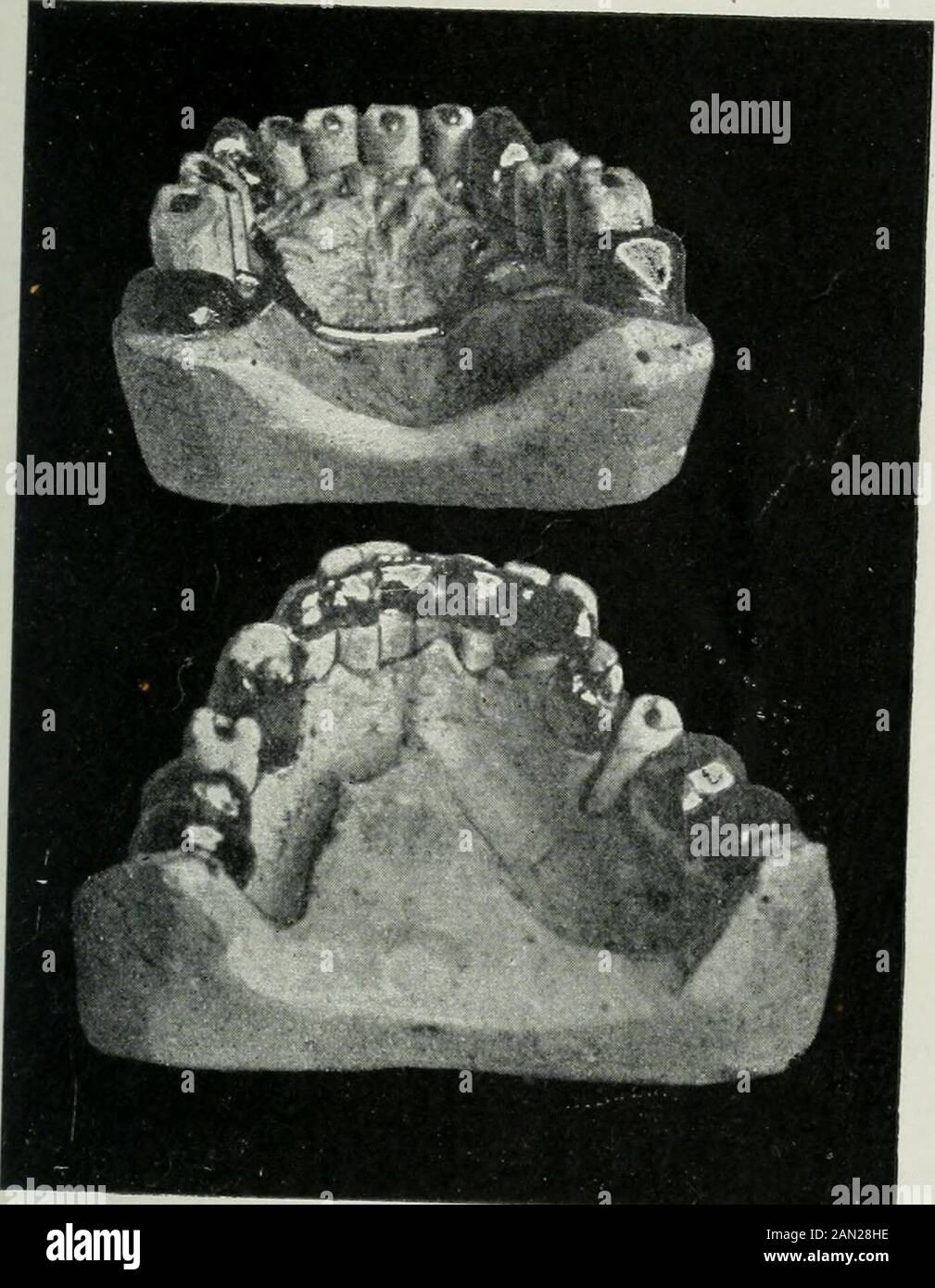 Spiders have teeth hi-res stock photography and images - Alamy