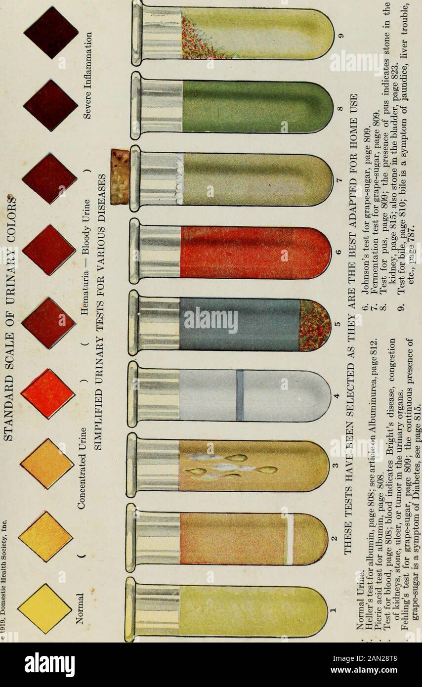 Bile Color Chart