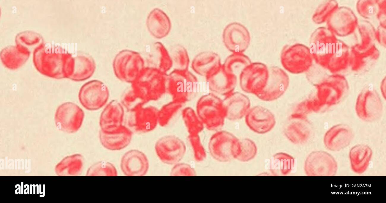Globules rouges hi-res stock photography and images - Alamy