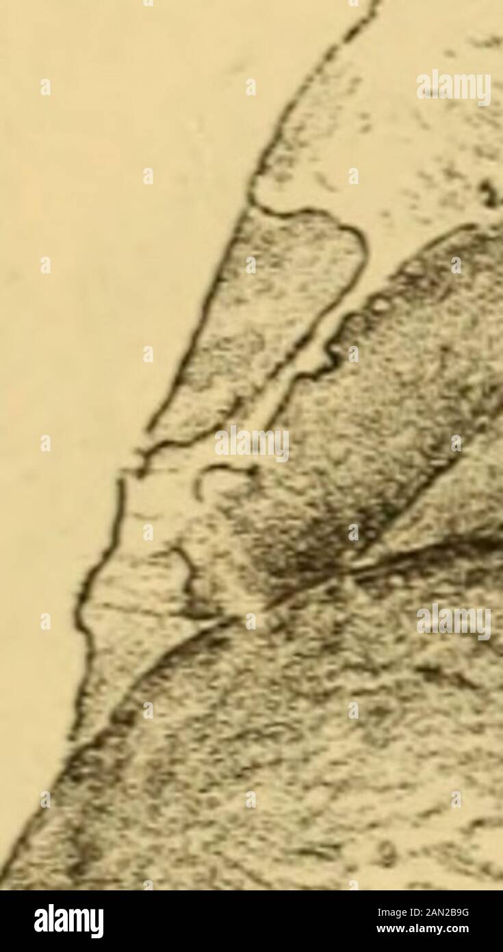 Lost his nerve hi-res stock photography and images - Alamy