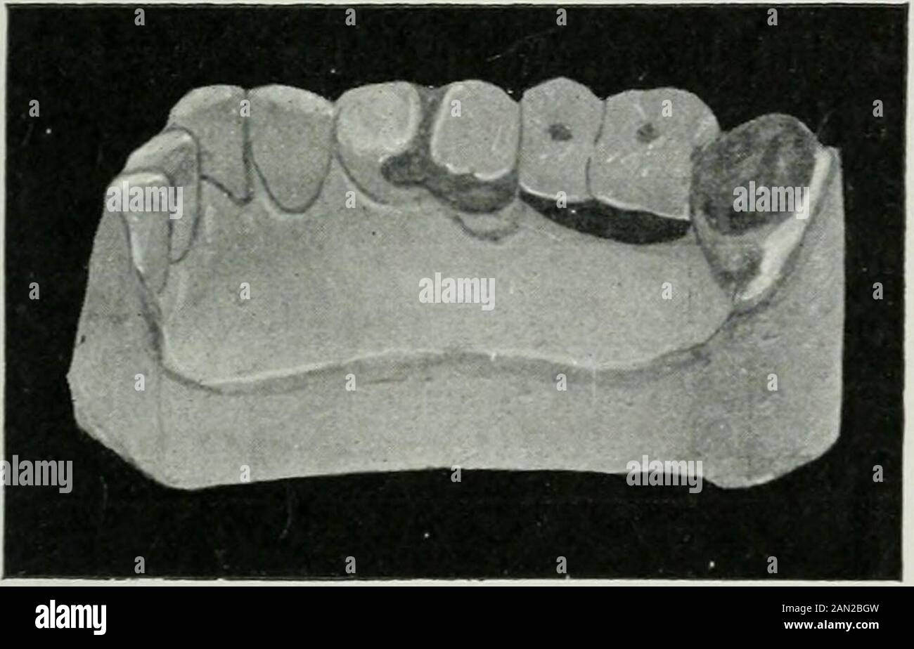 Inhalf hi-res stock photography and images - Alamy