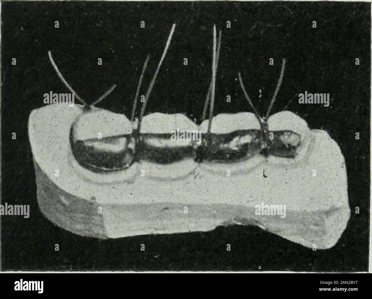 The tightening of loose teeth: some technical innovations . Fig. 22 ...