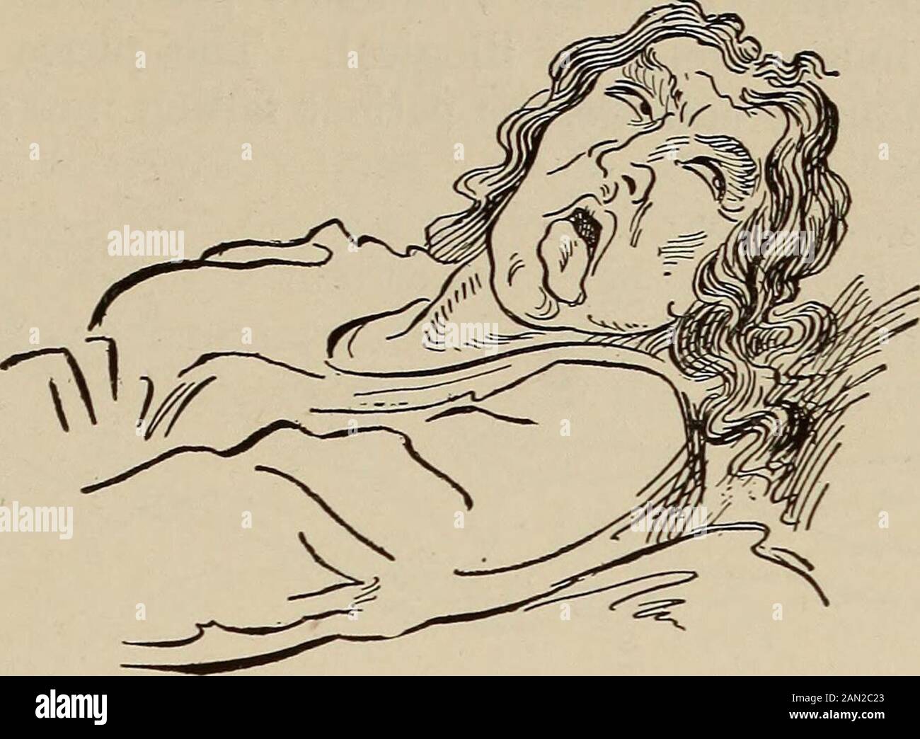 Nervous and mental diseases . ht cry. Thepatient is rigid ; the face is ...