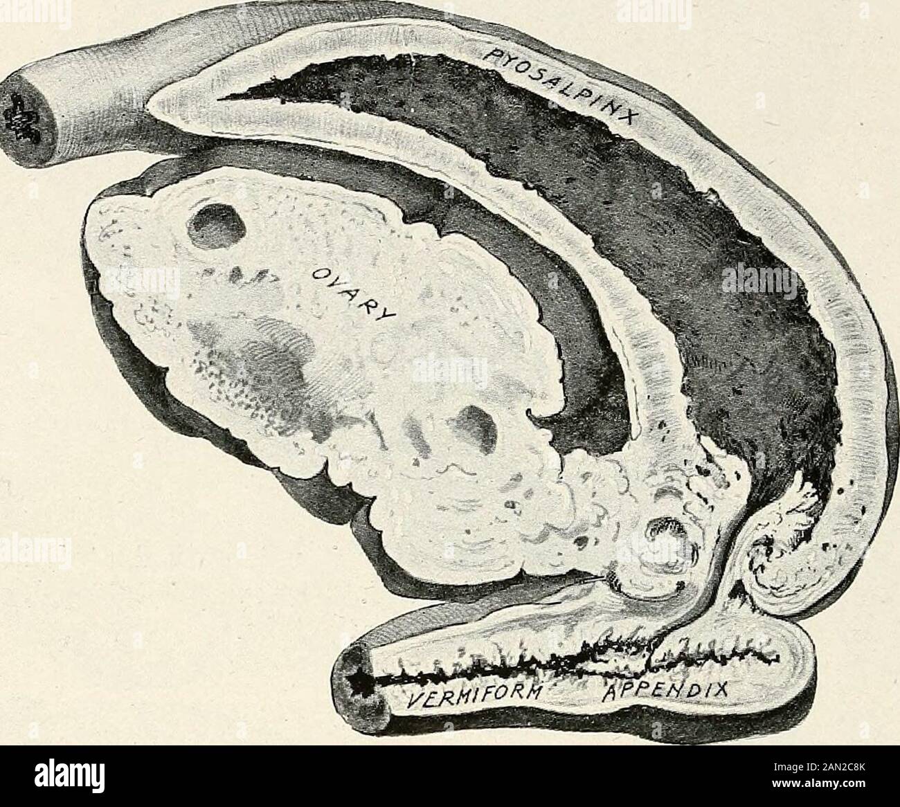 Gynaecology for students and practitioners . med near the abdominal end ...