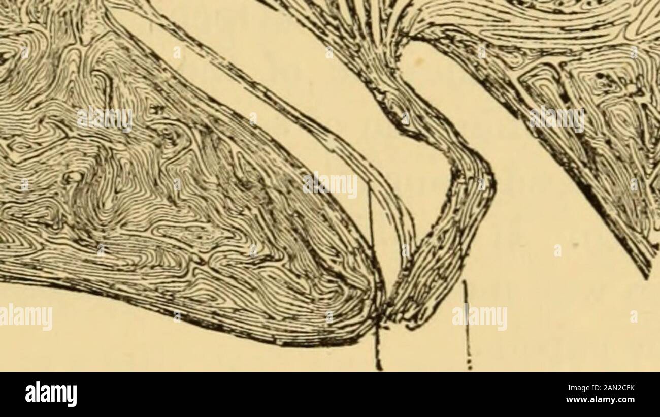 Hyperplastic hi-res stock photography and images - Alamy