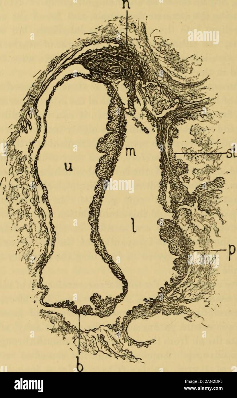 Otitis interna hi-res stock photography and images - Alamy