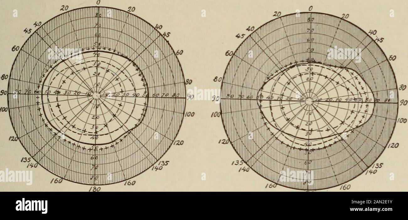 Macropsia hi-res stock photography and images - Alamy