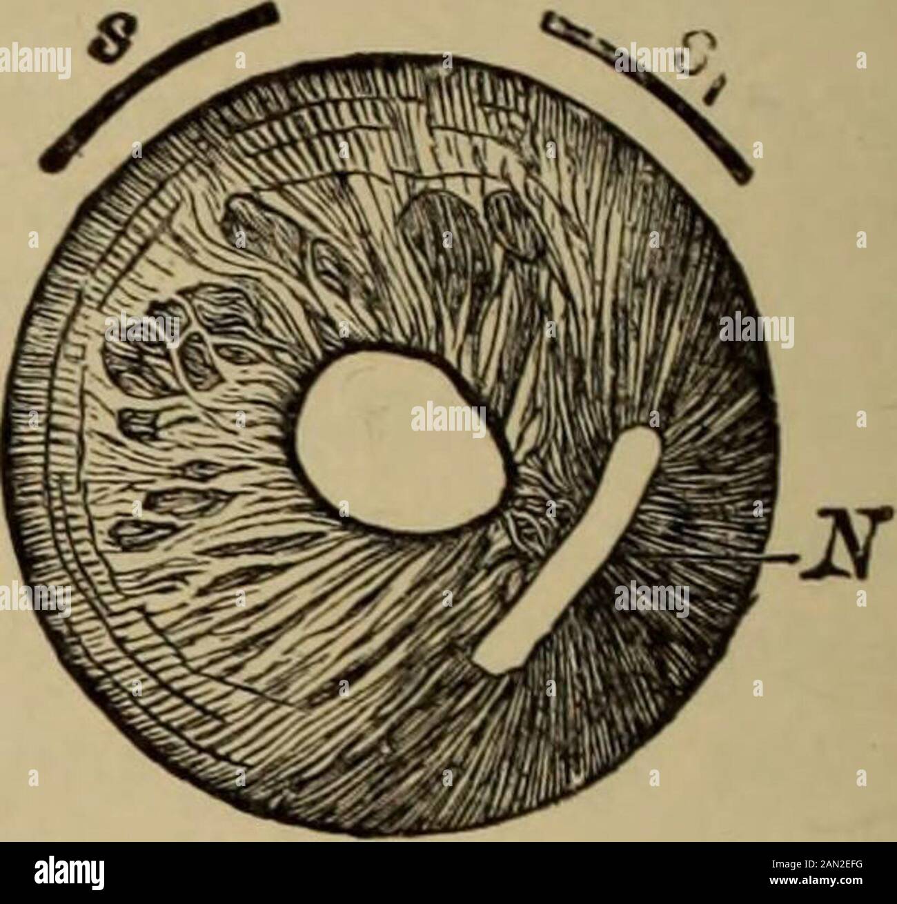 Corneal flap hi-res stock photography and images - Alamy