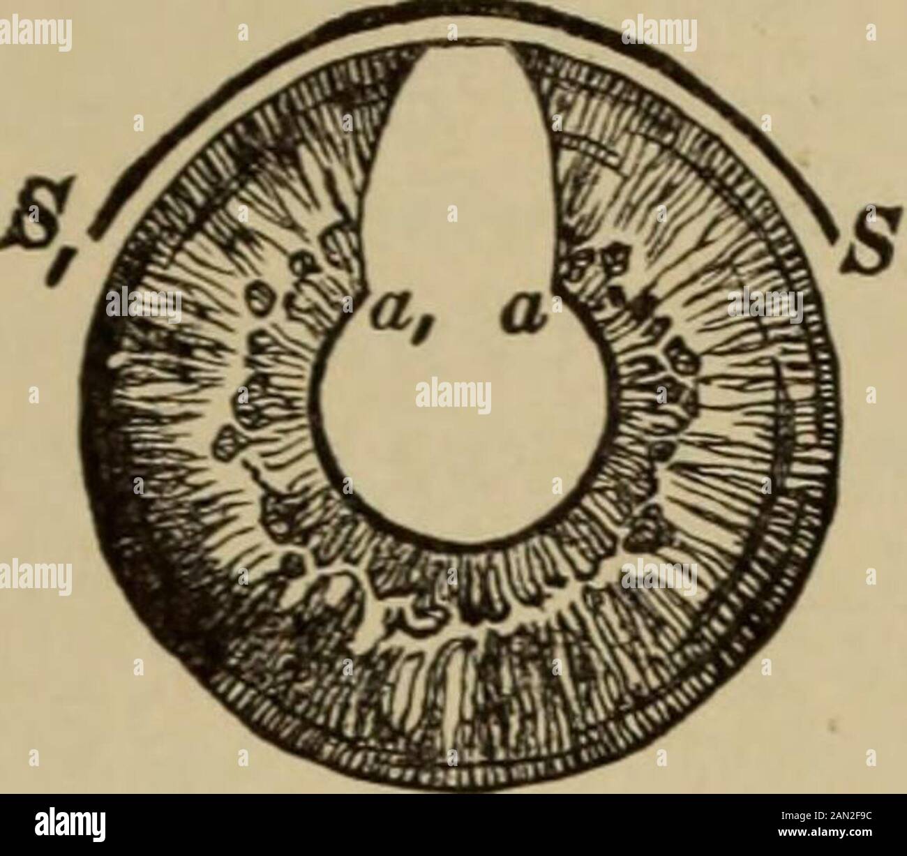 Proper wound hi-res stock photography and images - Alamy