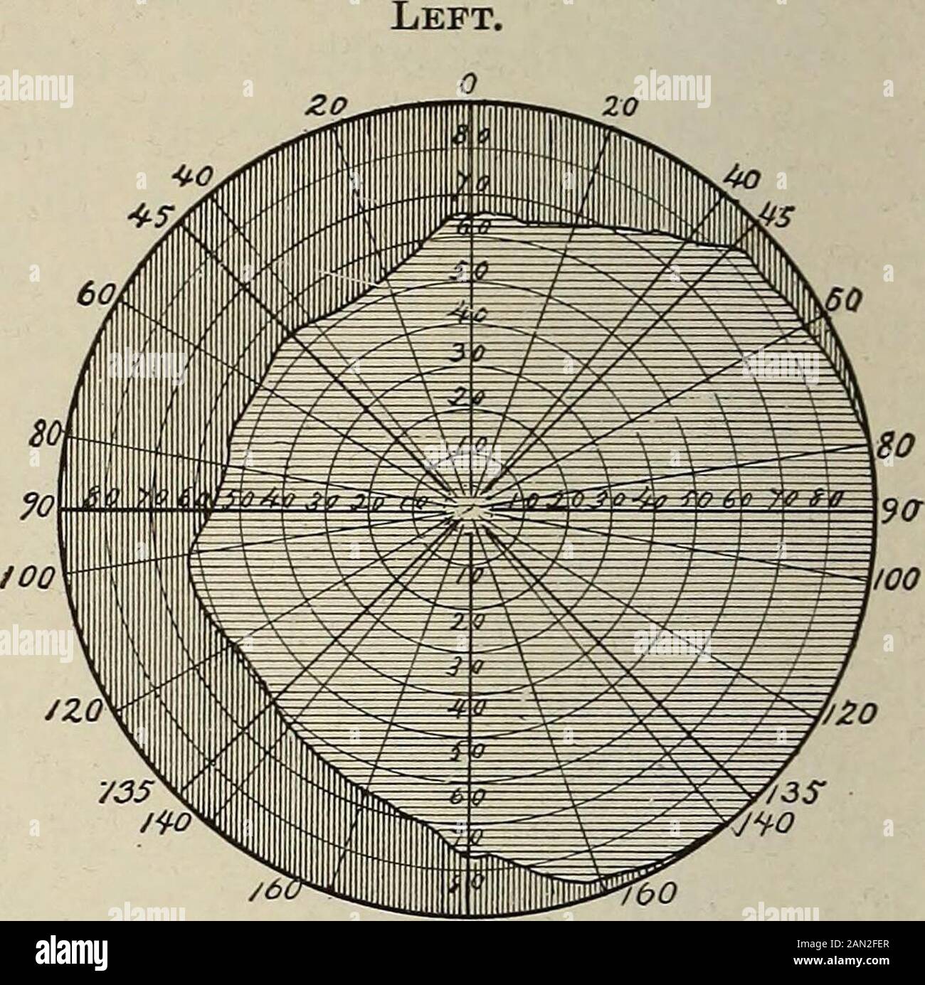 Nervous and mental diseases . Fig. 248.—Hysterical concentric ...