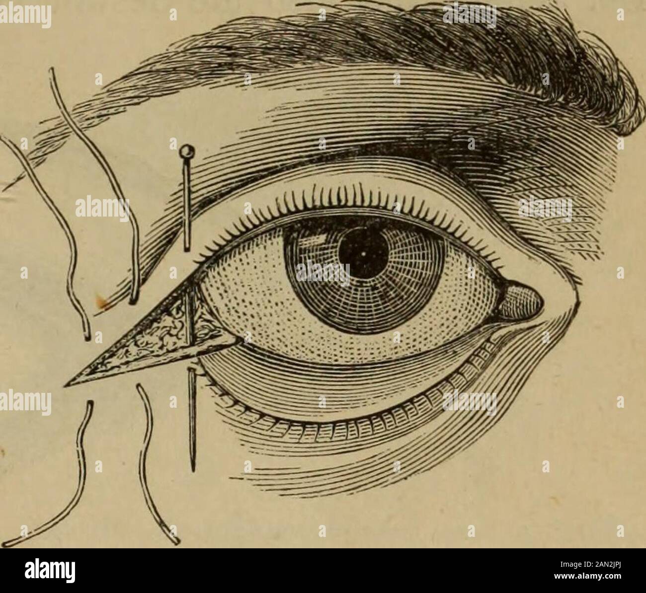 Operationsmethoden hi-res stock photography and images - Alamy