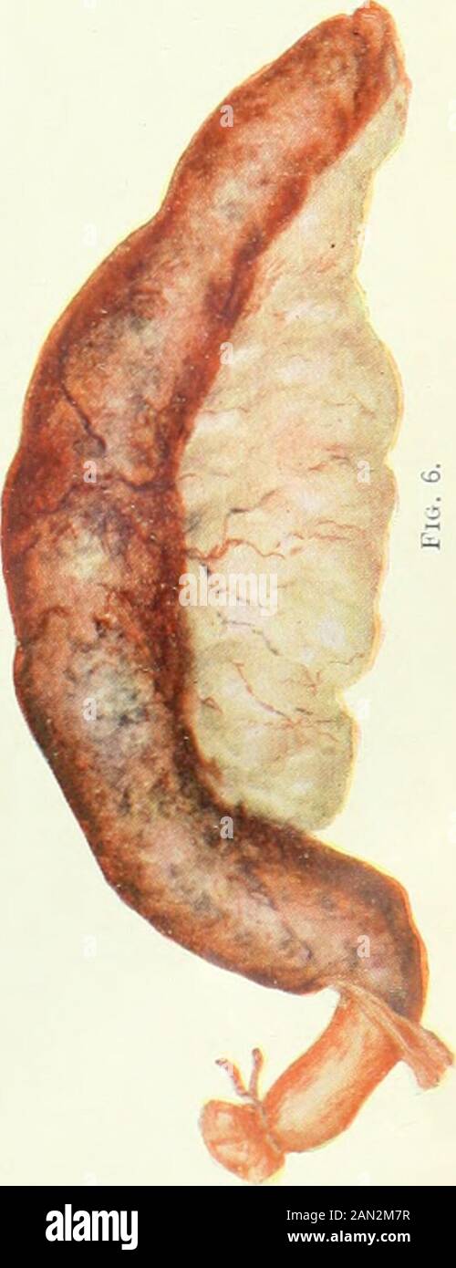 Putrefactive bacteria hi-res stock photography and images - Alamy