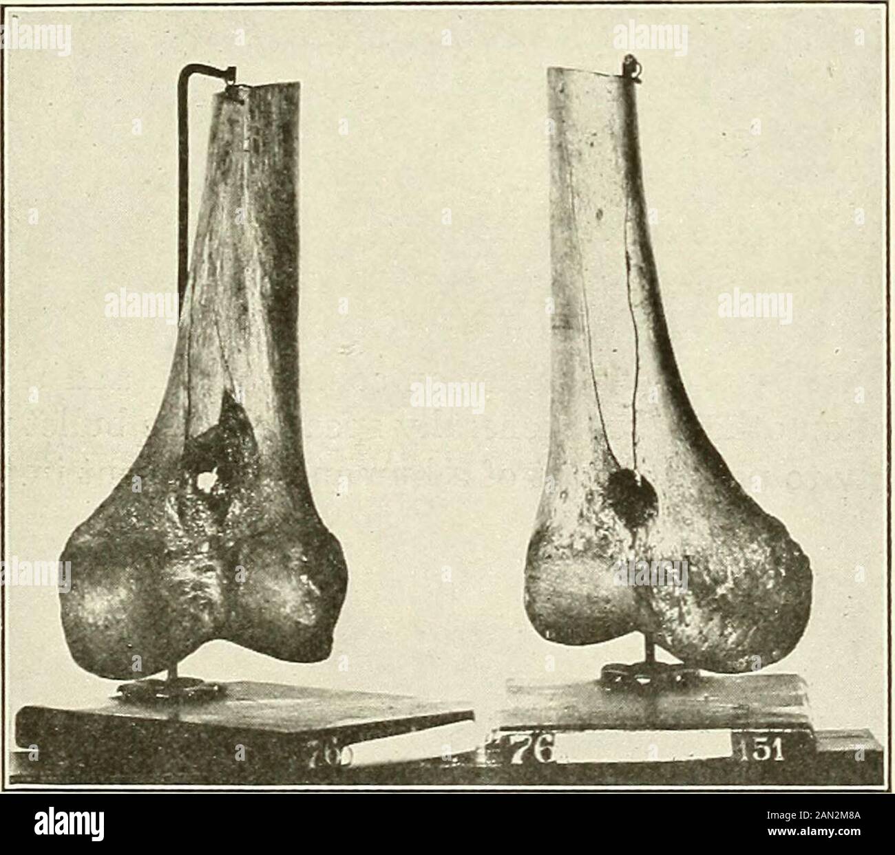 Gunshot injuries : how they are inflicted : their complications and ...