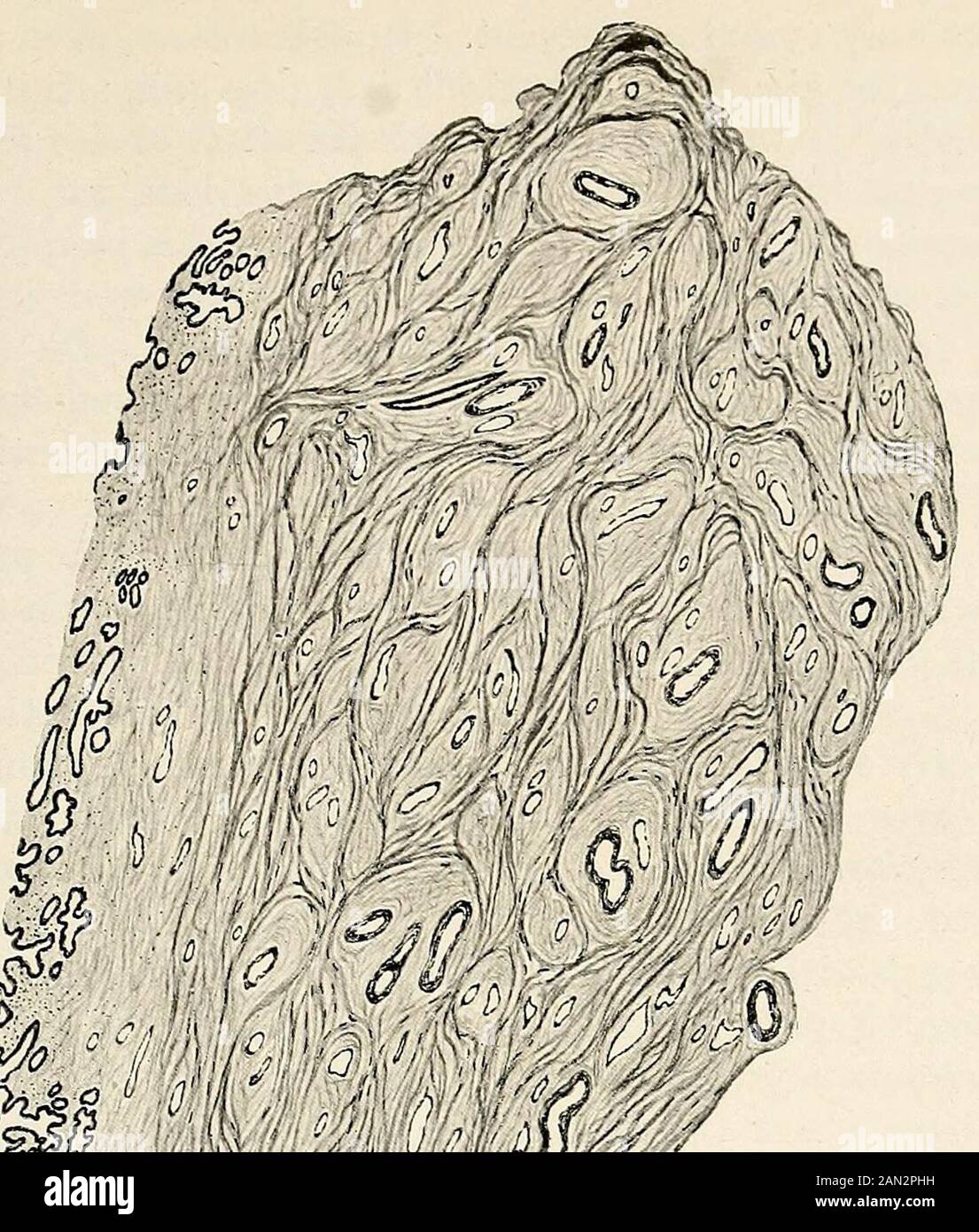 Gynaecology for students and practitioners . Fig. 319. Hypertrophic ...