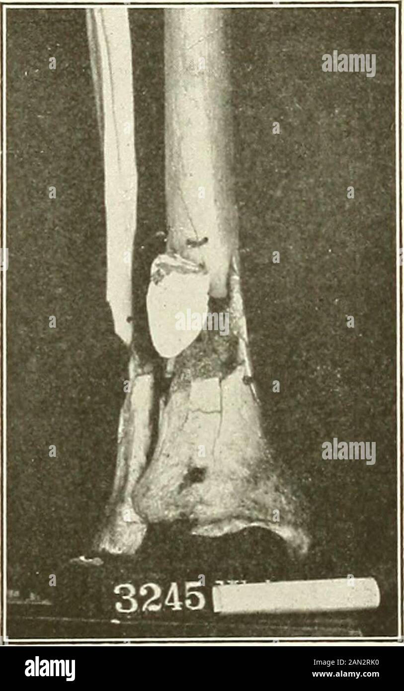 Pathologic Condition High Resolution Stock Photography and Images - Alamy