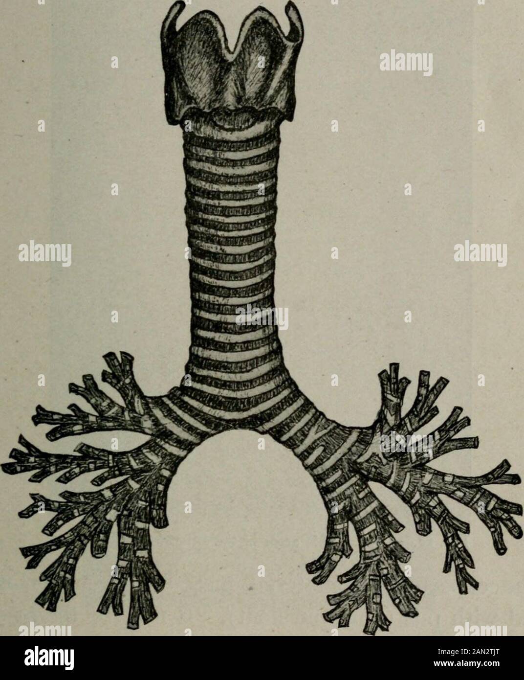 Diseases of children, for nurses, including infant feeding, therapeutic ...