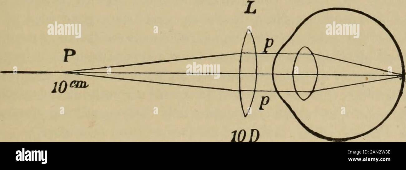 Supplementary lens hi-res stock photography and images - Alamy