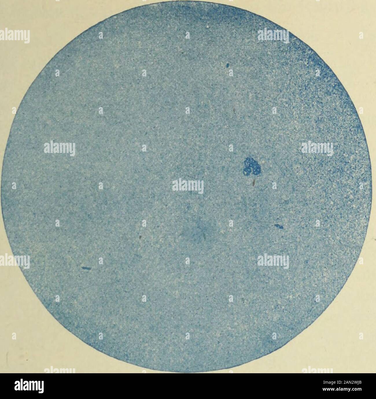 Microscope lactic acid bacteria hi-res stock photography and images - Alamy