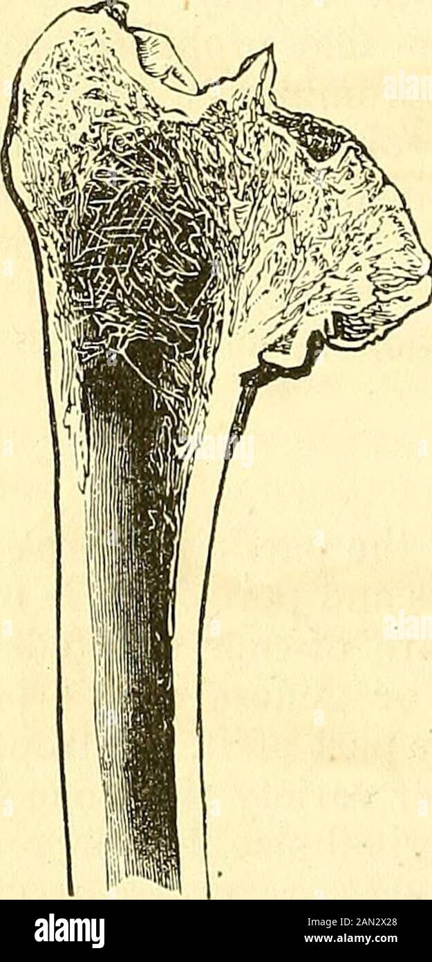 A system of surgery : pathological, diagnostic, therapeutic, and ...