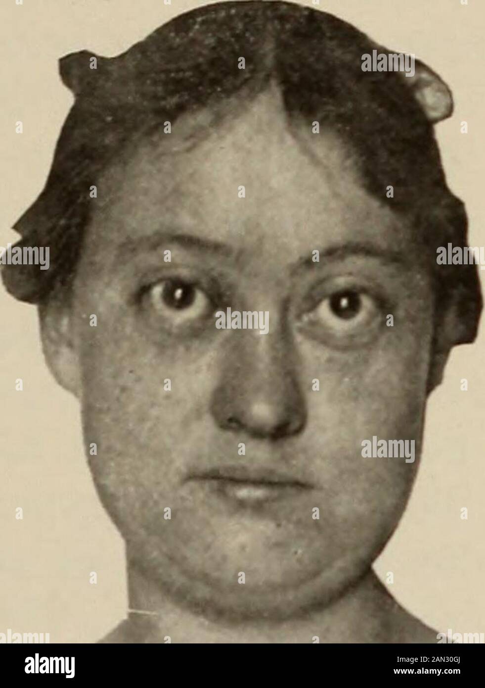 Nervous and mental diseases . xperienced judgment to recognize the ...