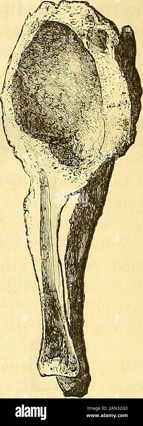 A system of surgery : pathological, diagnostic, therapeutic, and ...