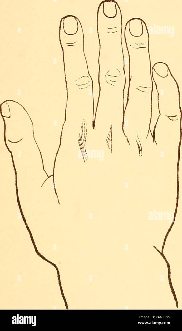The language of the hand, being a concise exposition of the principles ...