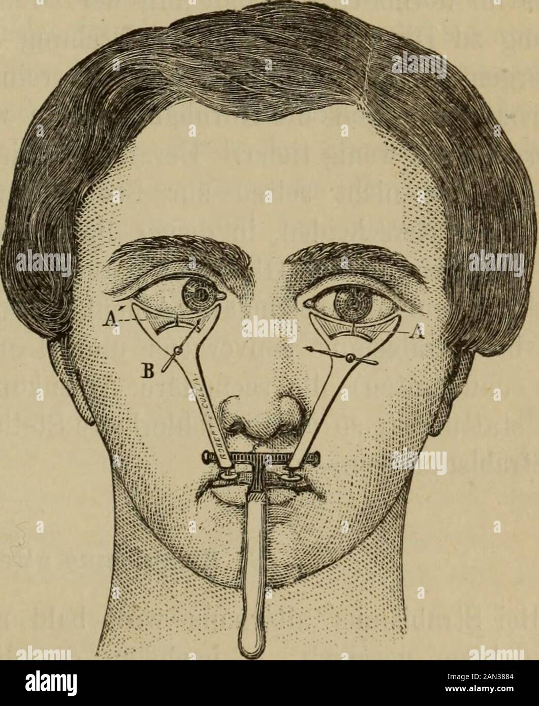 Strabismus divergens hi-res stock photography and images - Alamy