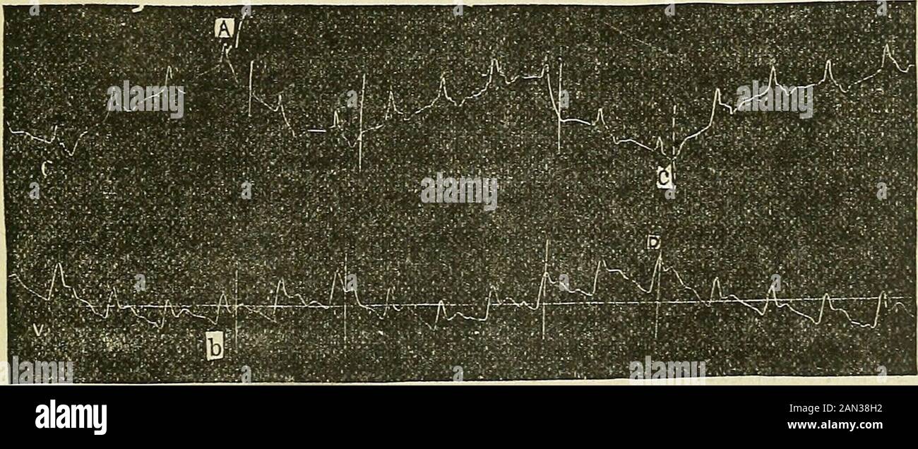 The laws and mechanics of circulation, with the principle involved in ...