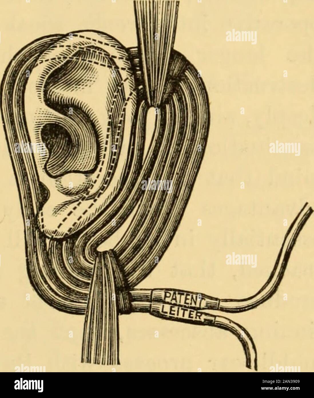 Leech text hi-res stock photography and images - Alamy