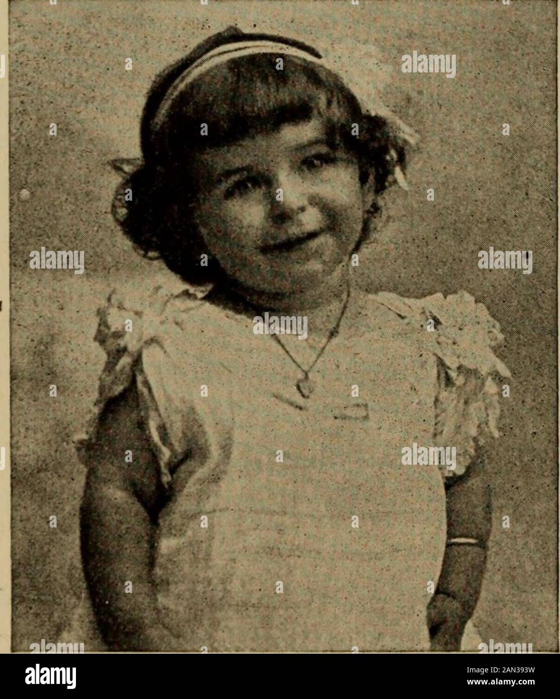 Diplopia hi-res stock photography and images - Alamy