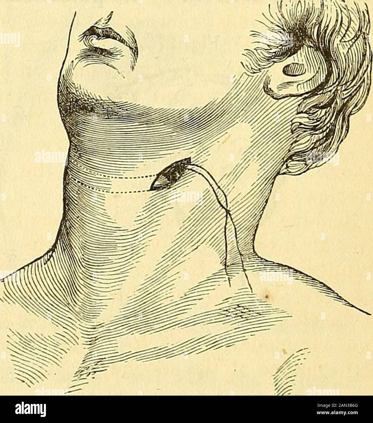 A system of surgery : pathological, diagnostic, therapeutic, and ...