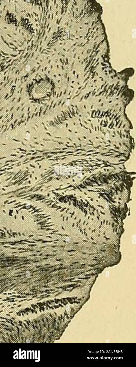 Pathology and treatment of diseases of women Stock Photo - Alamy