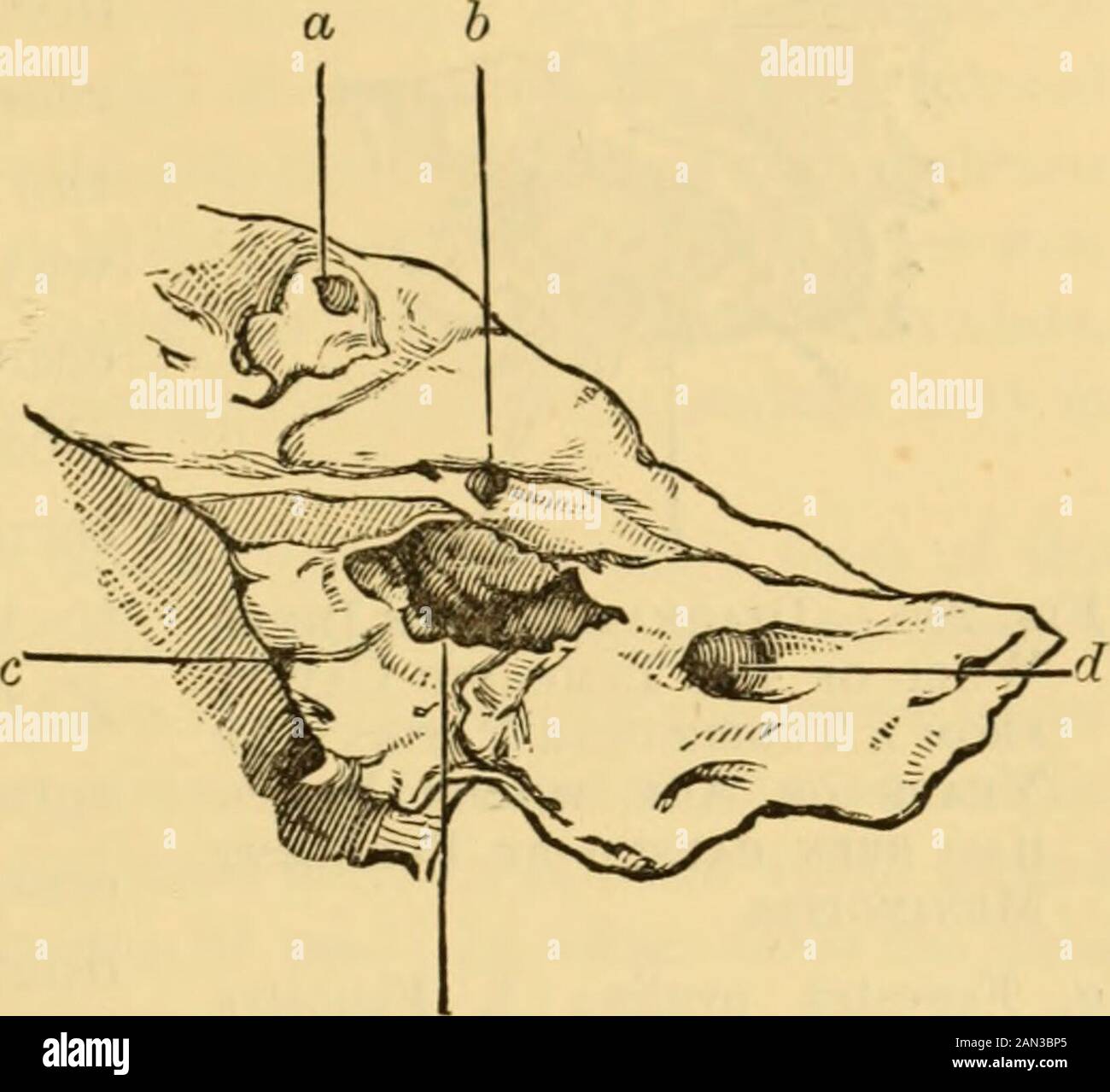 Ear canal abscess hi-res stock photography and images - Alamy