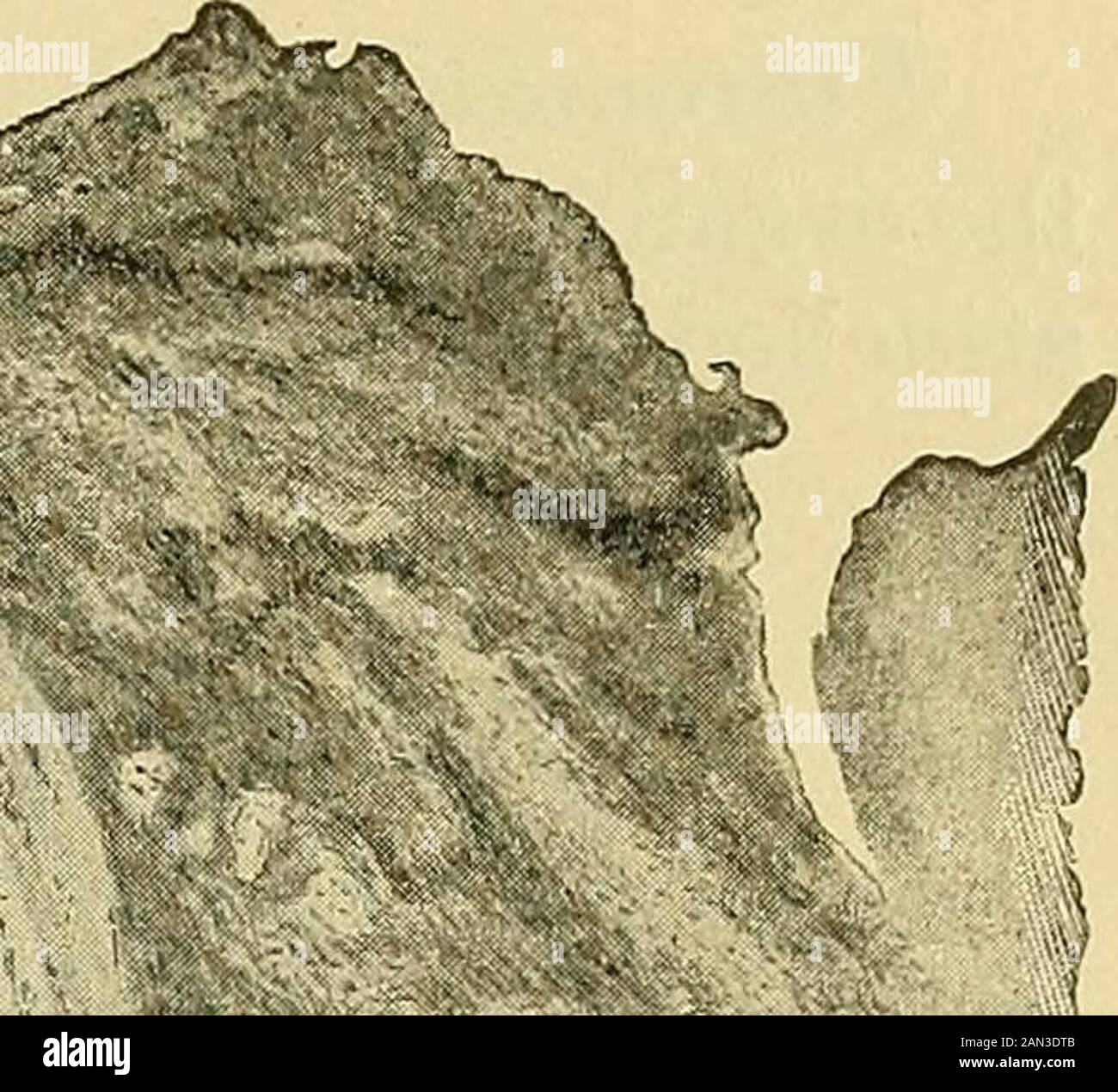 Pathology and treatment of diseases of women Stock Photo - Alamy