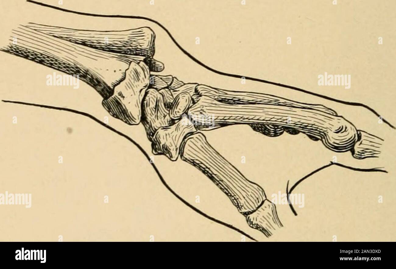 Styloid process hi-res stock photography and images - Alamy