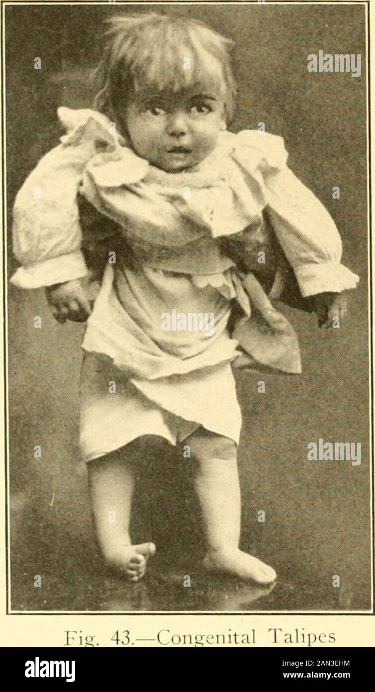 Modern diagnosis and treatment of diseases of childern; a treatise on ...