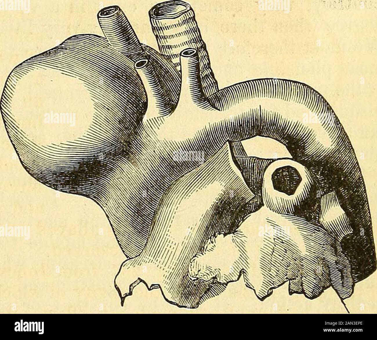 A system of surgery : pathological, diagnostic, therapeutic, and ...